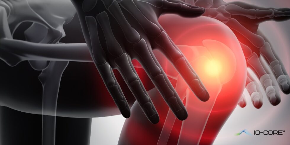 What Are Chondral Defects? | iO-Core