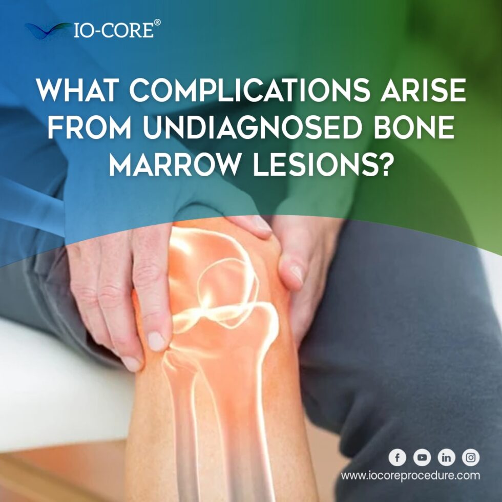 What Complications Arise From Undiagnosed Bone Marrow Lesions? | iO-Core